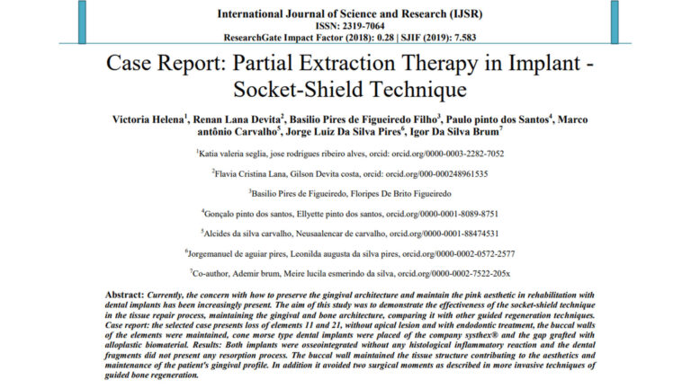 Partial Extraction Therapy in Implant - Socket-Shield Technique ...